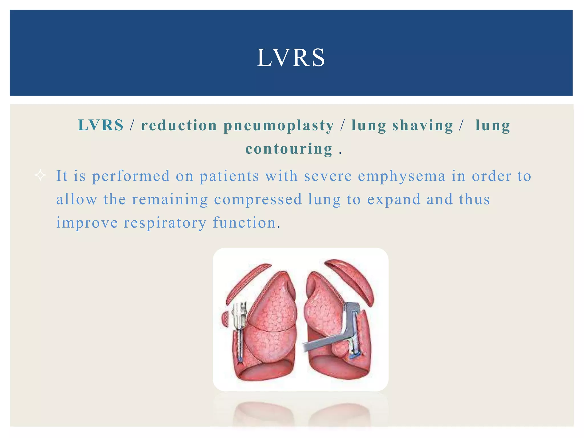 Lung volume reduction surgery ( LVRS ) | PPTX