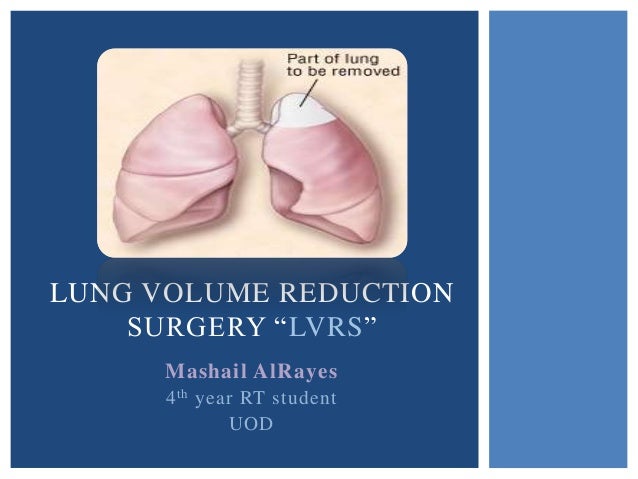 Lung volume reduction surgery ( LVRS )