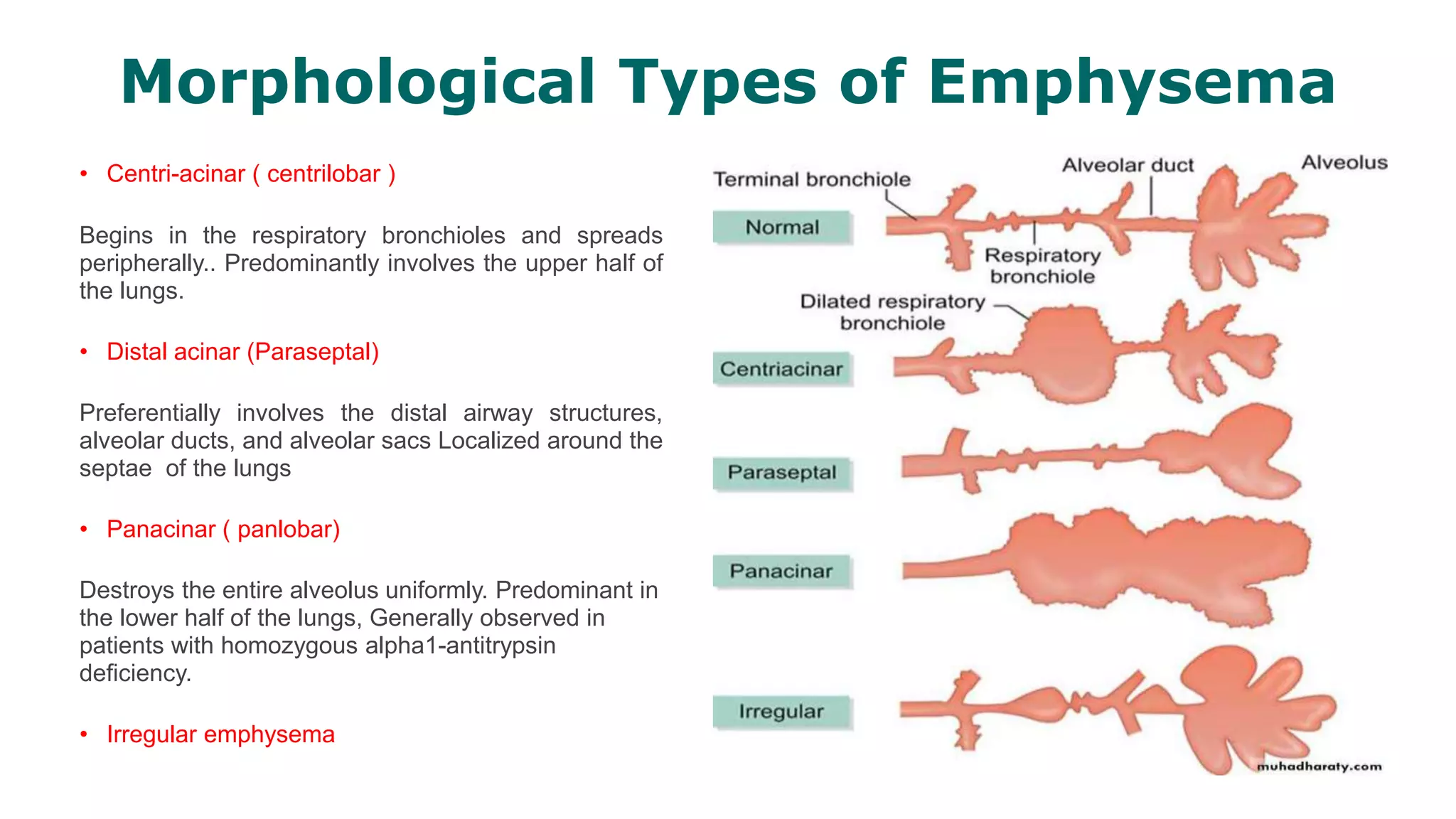 Lung Volume Reduction Surgery | PPTX