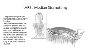 Lung Volume Reduction Surgery | PPTX