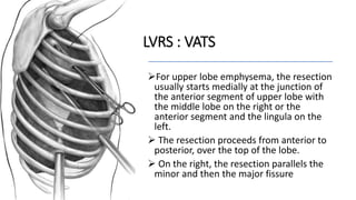 Lung Volume Reduction Surgery | PPTX