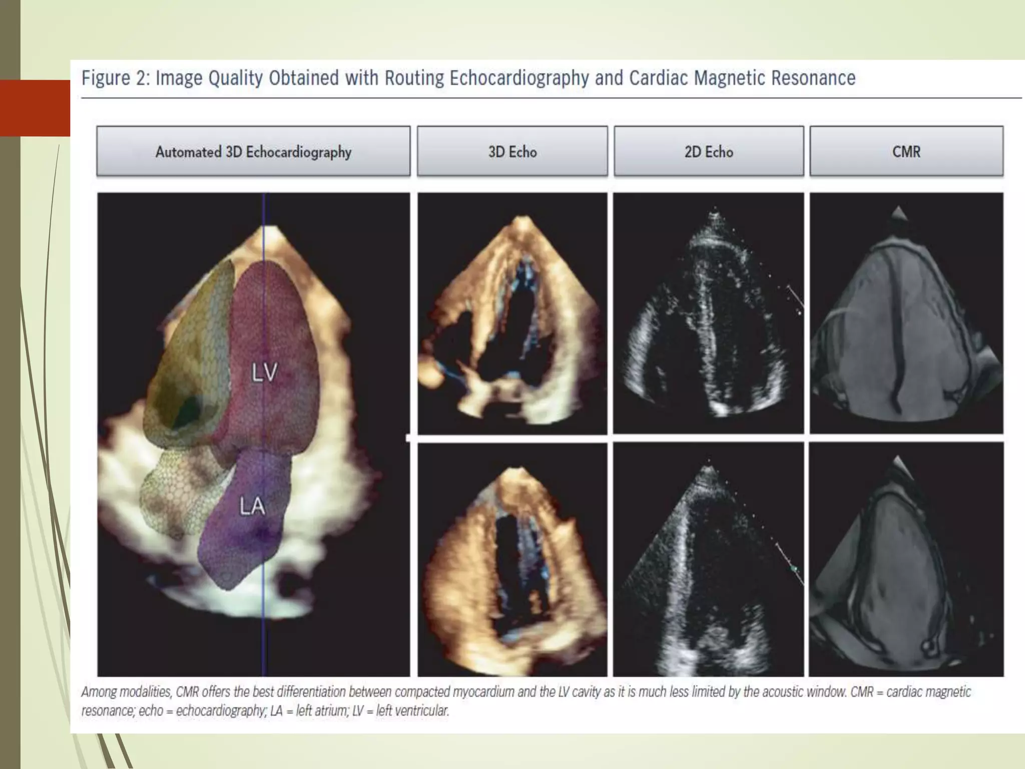 Lv systolic function | PPTX