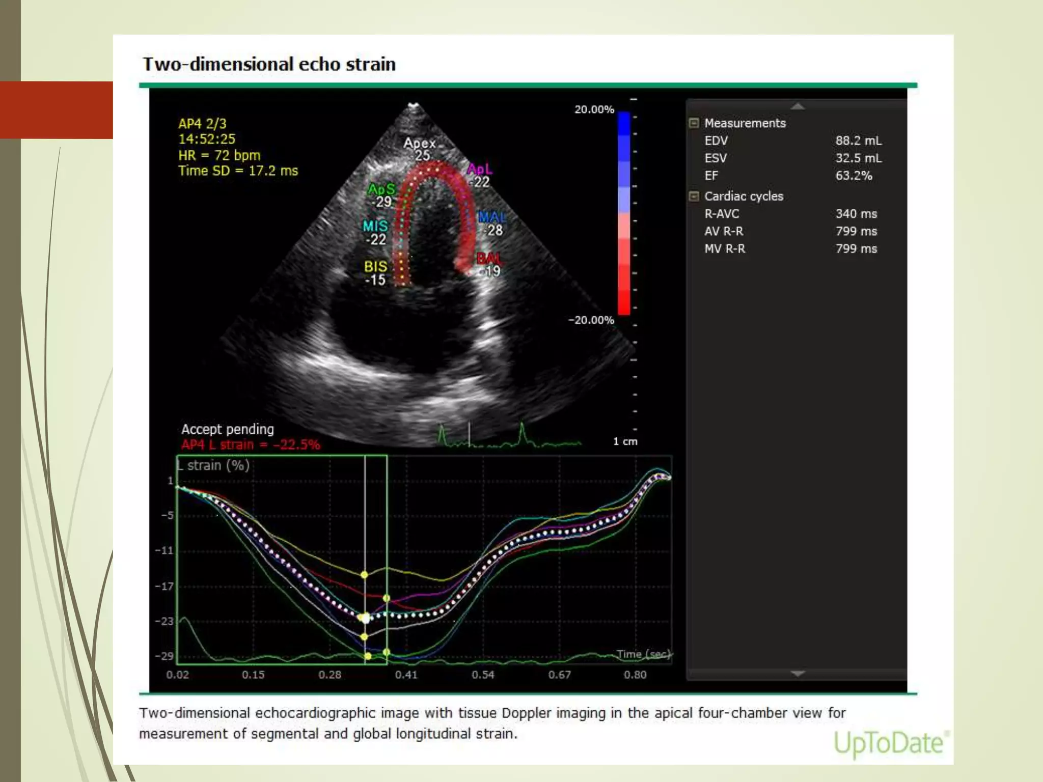 Lv systolic function | PPTX