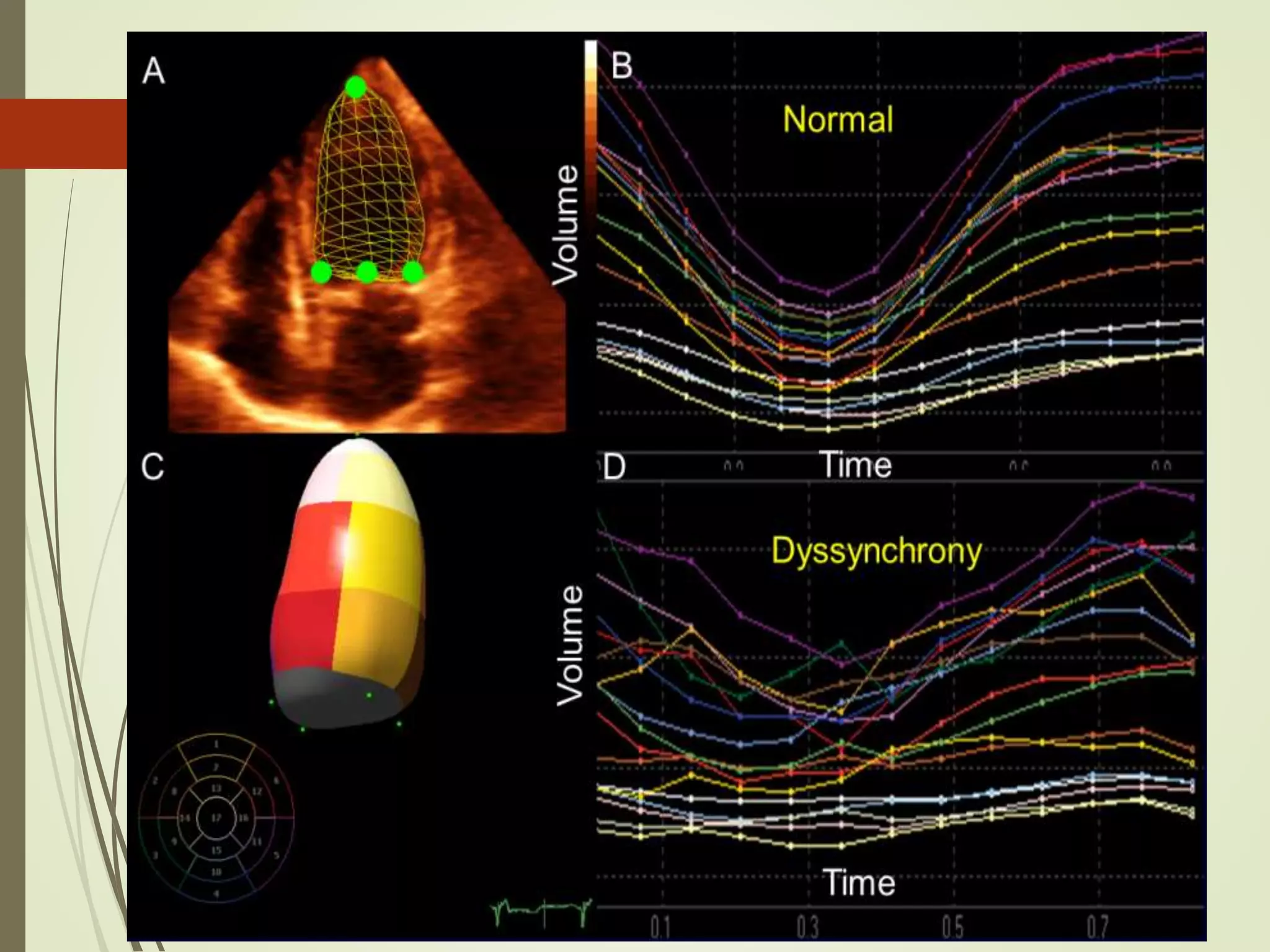 Lv systolic function | PPTX