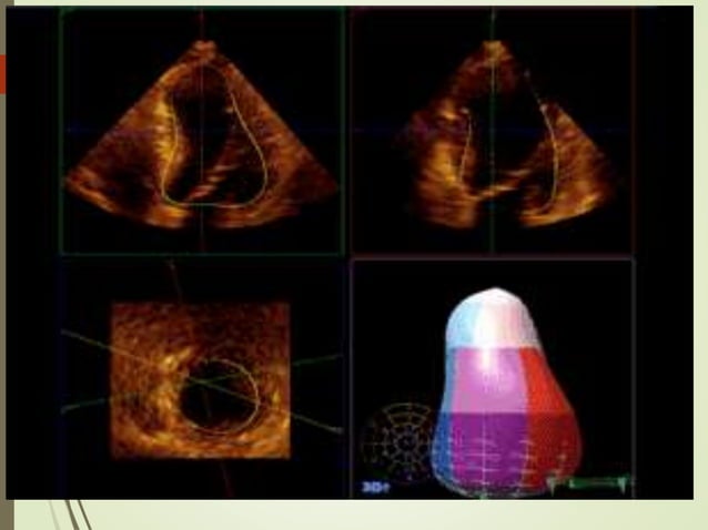 Lv systolic function | PPTX