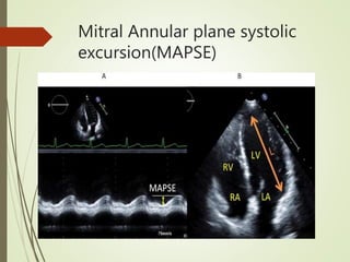 Lv systolic function | PPTX
