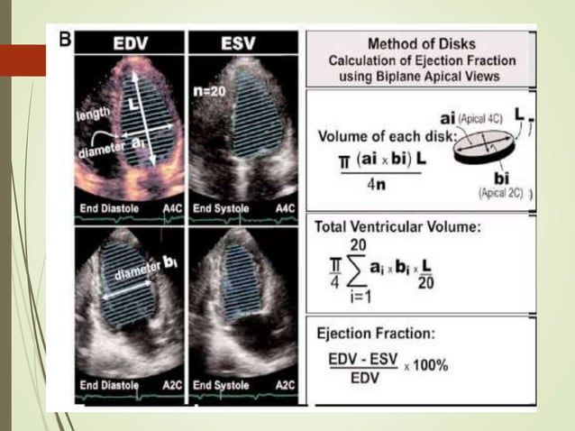 Lv systolic function | PPTX