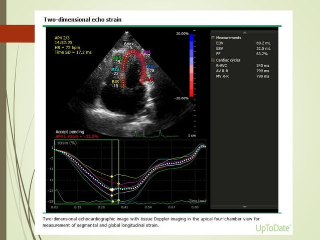 Lv systolic function | PPTX
