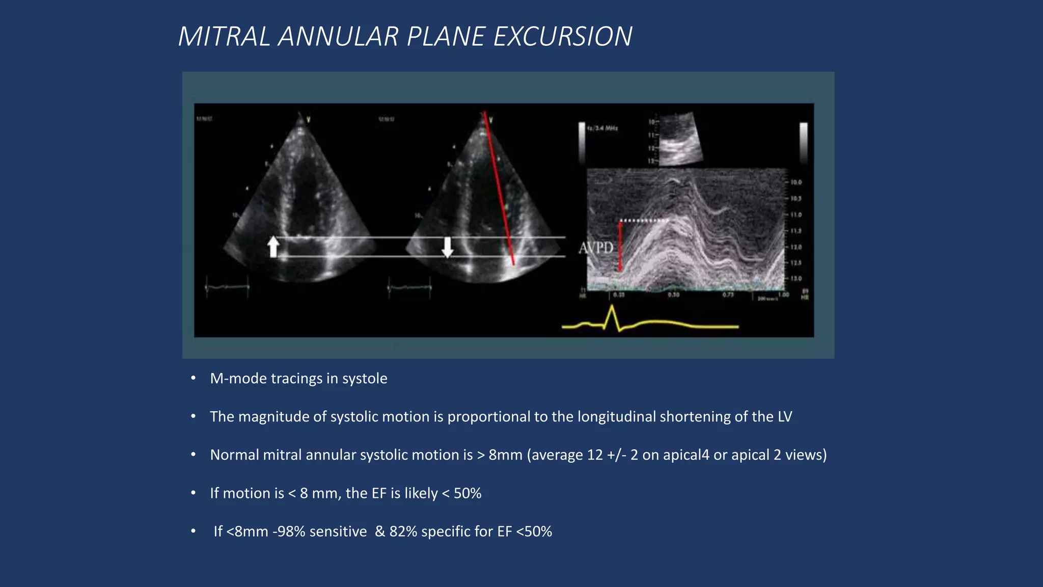 Lv systolic function | PPTX