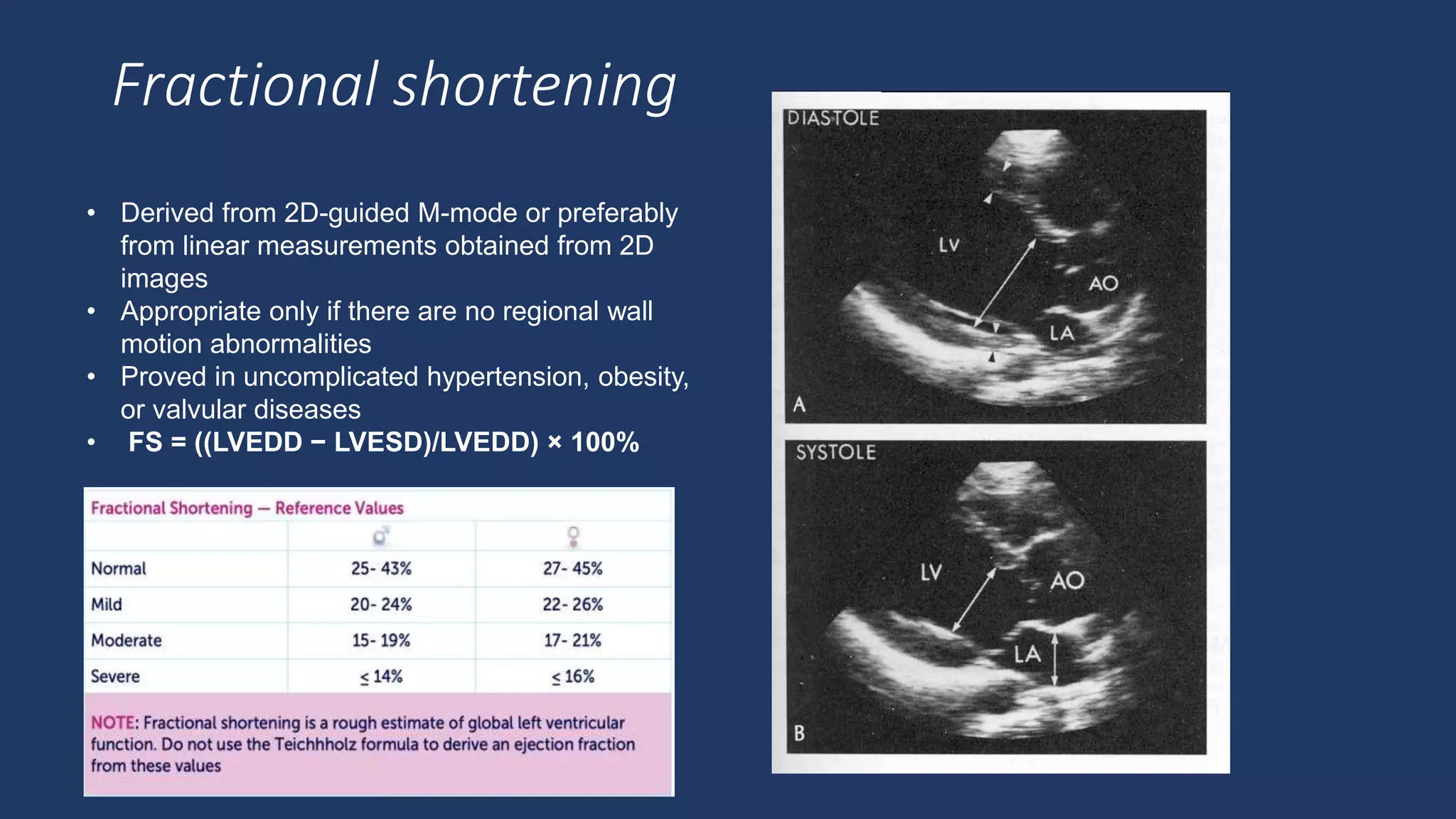 Lv Systolic Function Ppt