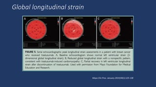 Lv systolic function | PPTX