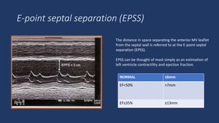 Lv systolic function | PPTX
