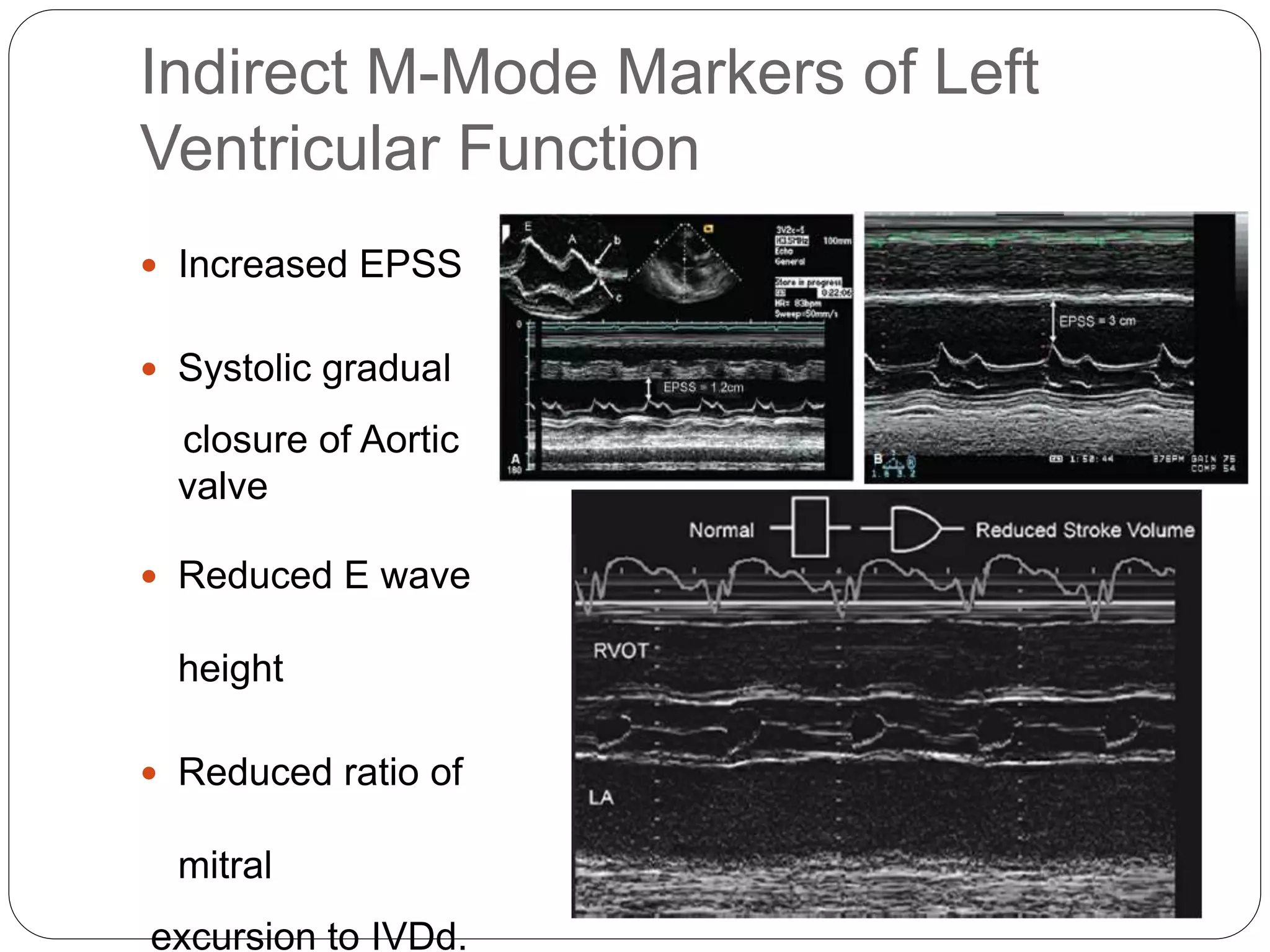 LV Systolic Function.pptx