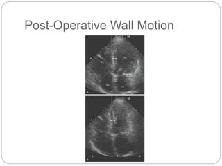 LV Systolic Function.pptx