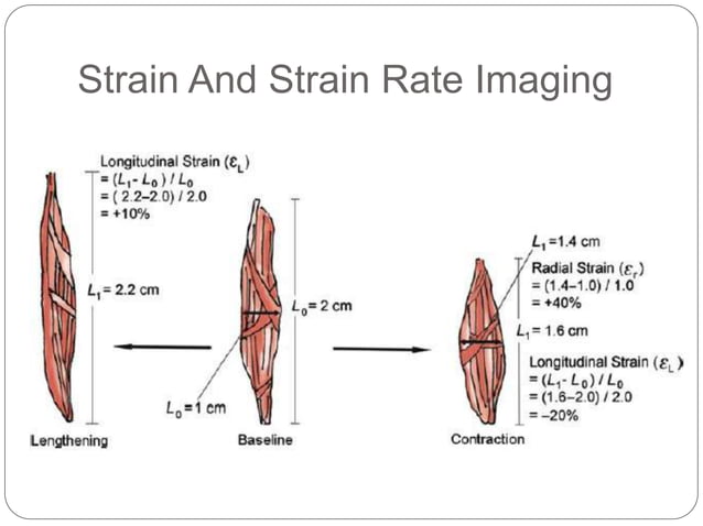 LV Systolic Function.pptx