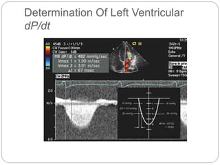 LV Systolic Function.pptx