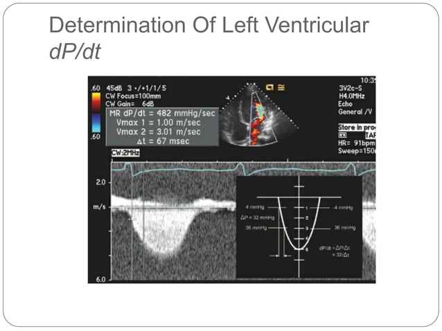 LV Systolic Function.pptx