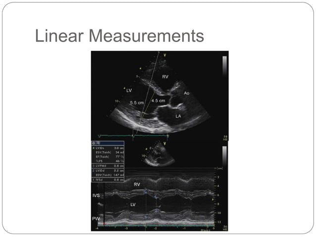 LV Systolic Function.pptx