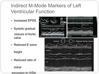 LV Systolic Function.pptx