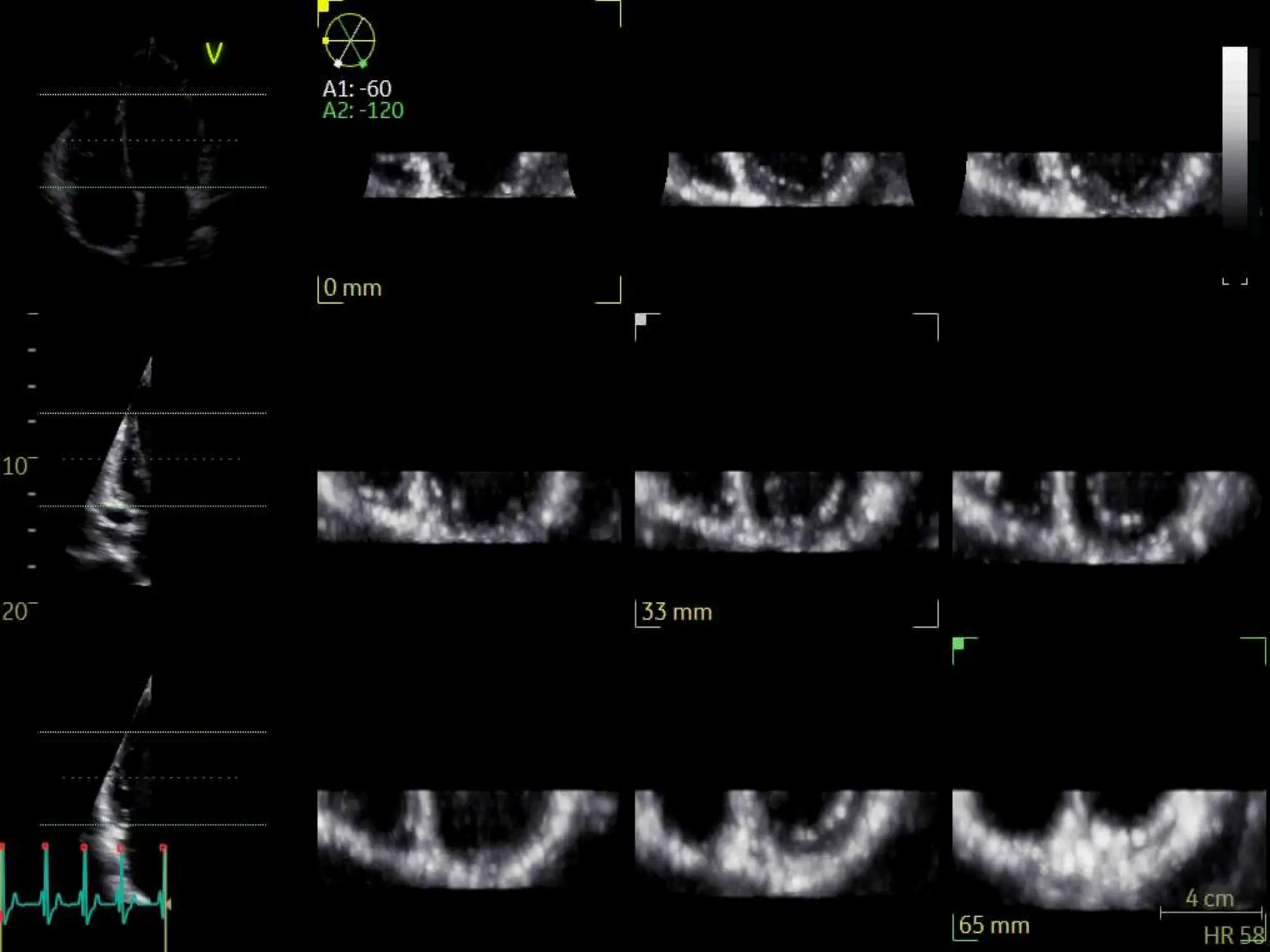 Lv Systolic Functionpptx 3 D Graphics Computer Software And Applications