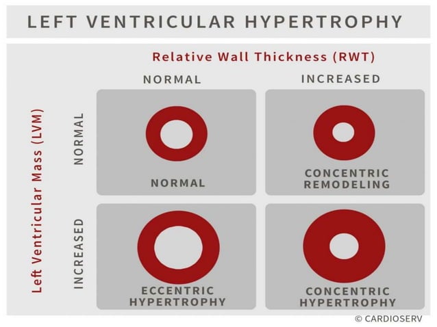 Lv Systolic Function Pptx