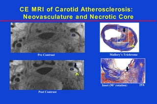 Mri blush sing | PPT