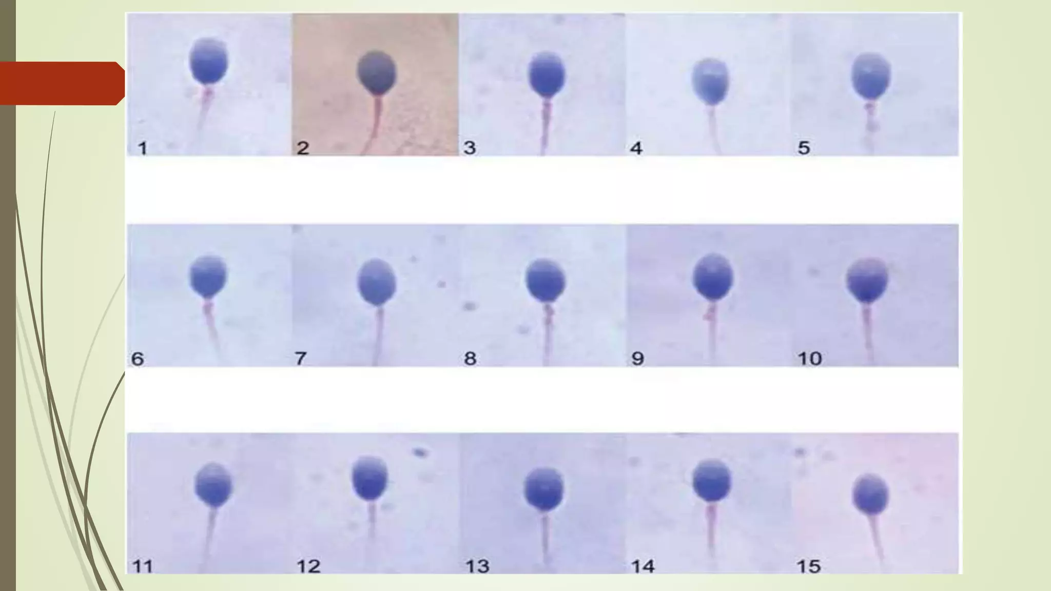 Sperm_Morphology.pptx