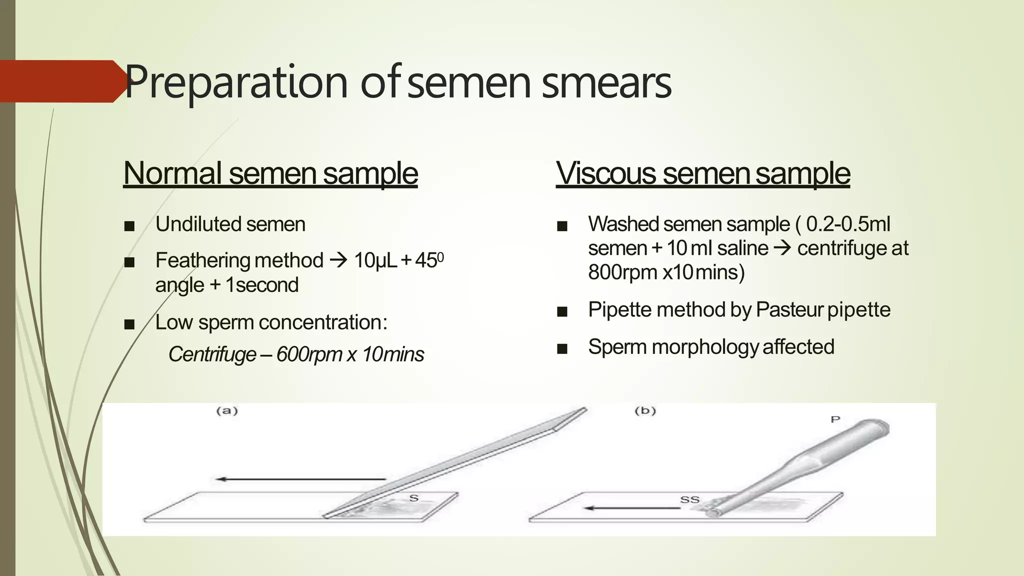 Sperm_Morphology.pptx