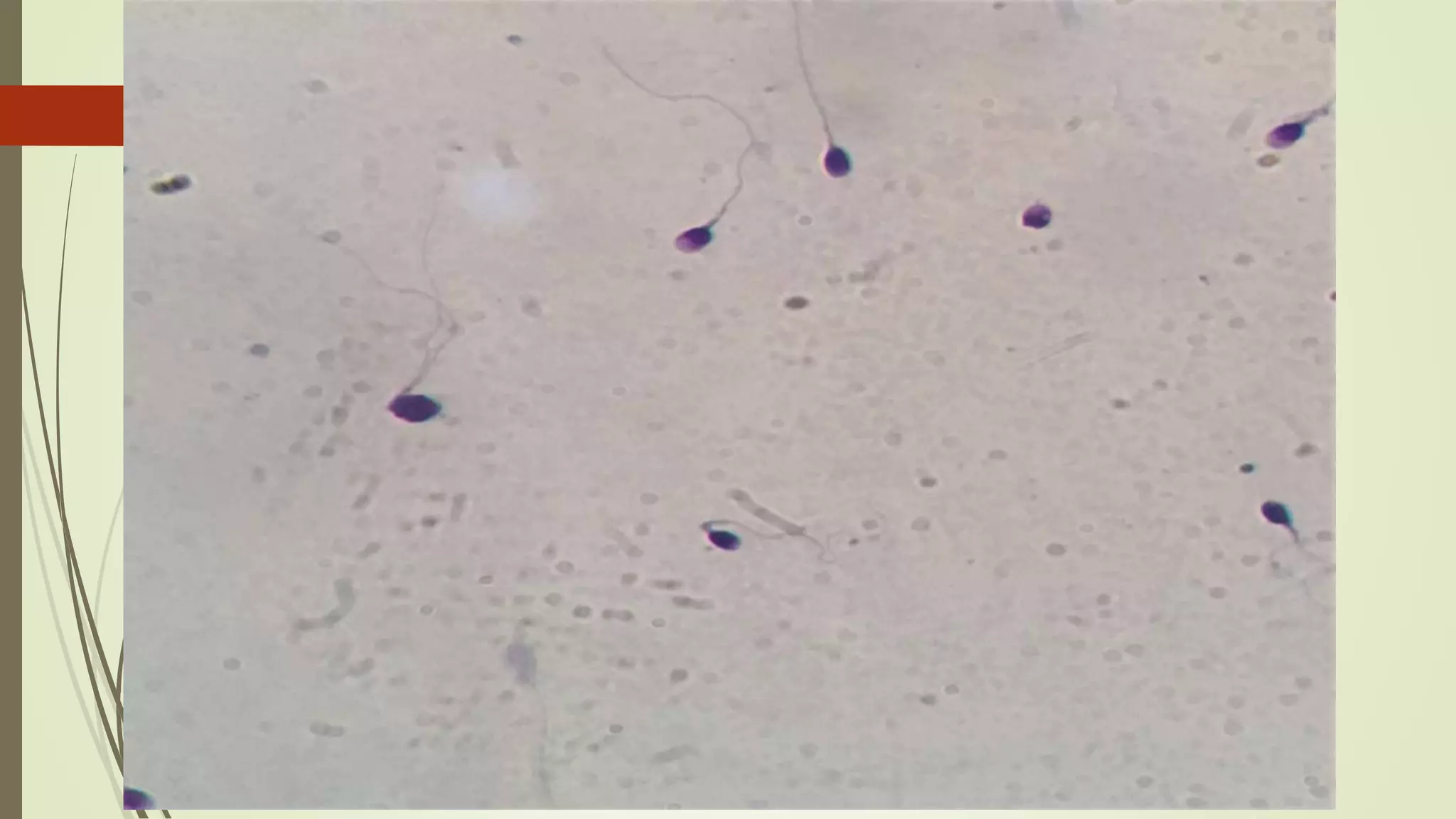 Sperm_Morphology.pptx