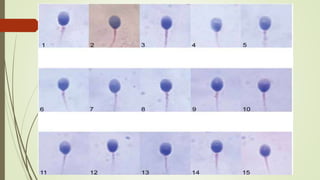 Sperm_Morphology.pptx
