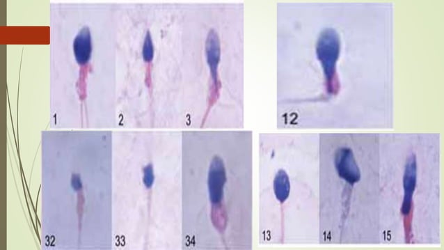 Sperm_Morphology.pptx | Infertility | Reproductive Health