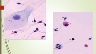 Sperm_Morphology.pptx