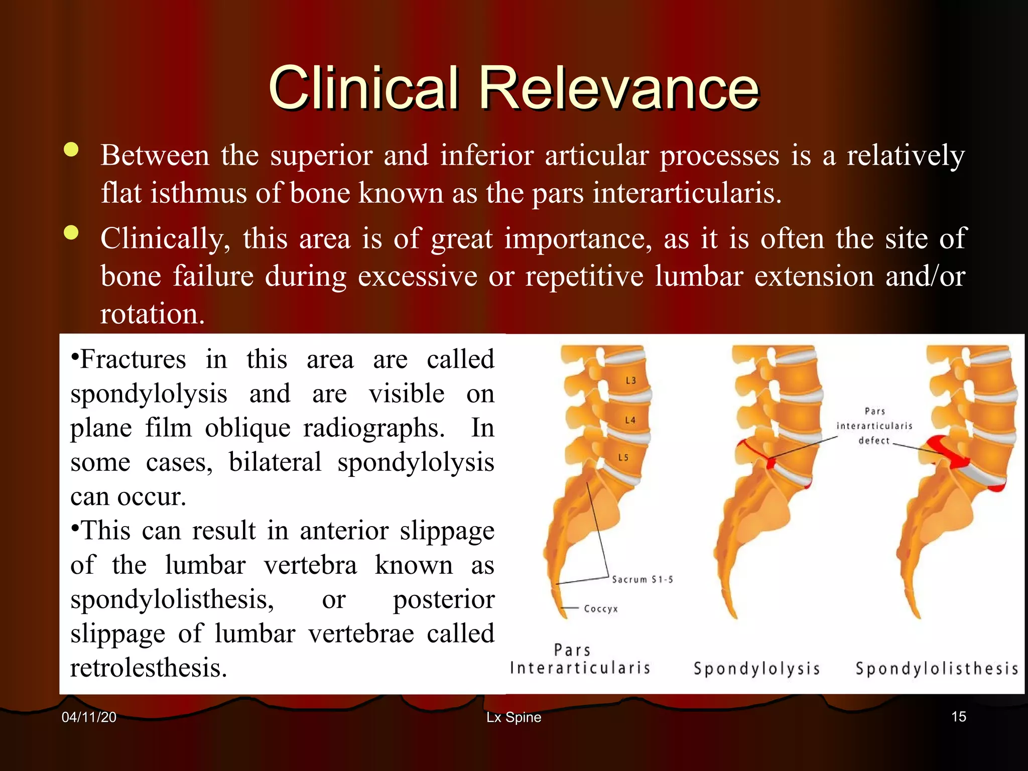 Lumbar Spnine: Anatomy, Biomechanics and Pathomechanics | PDF