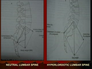 Lumbar Spnine: Anatomy, Biomechanics and Pathomechanics | PDF
