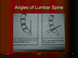 Lumbar Spnine: Anatomy, Biomechanics and Pathomechanics | PDF