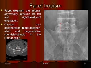 Lumbar Spnine: Anatomy, Biomechanics and Pathomechanics | PDF