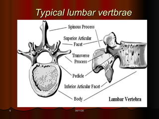 Lumbar Spine Transverse Process Fracture Everything You, 44% OFF