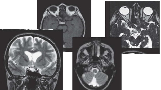 CNS Rapid Review of Radiology | PPT | Free Download