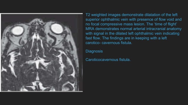 CNS Rapid Review of Radiology | PPT | Free Download