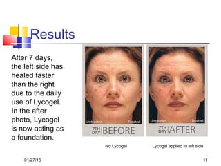 Lycogel mini training ppt | PPT