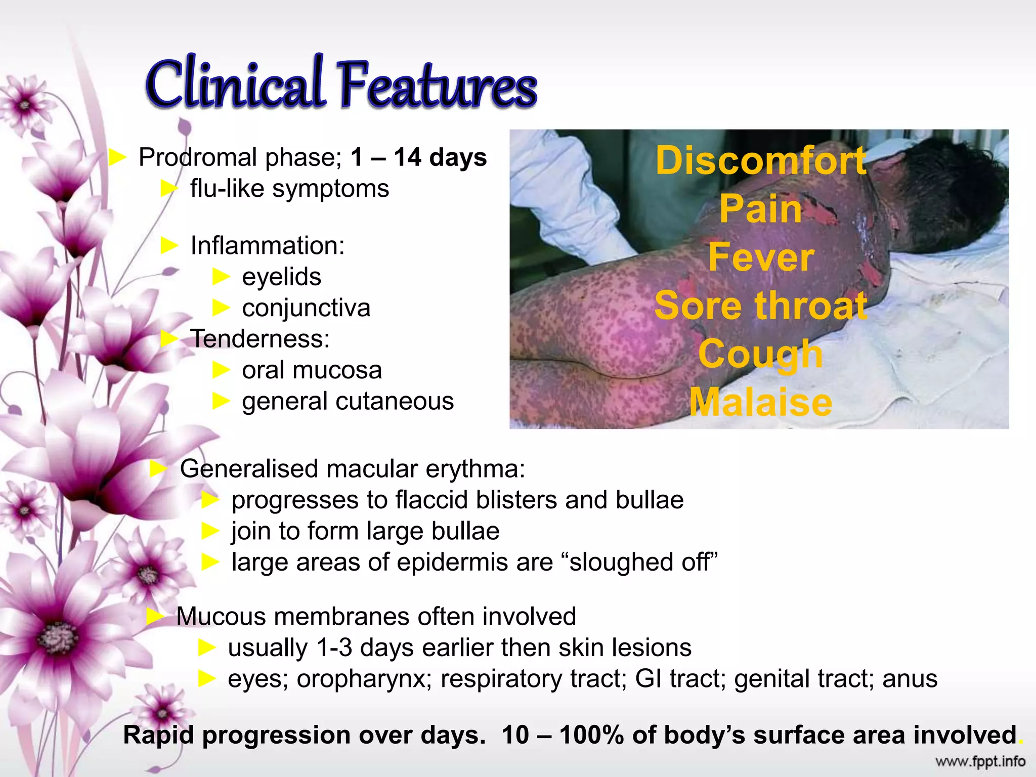 Lyell's syndrome or Toxic epidermal necrolysis | PPTX