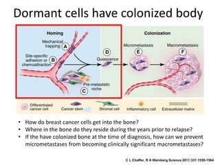Tumor Dormancy | PPTX