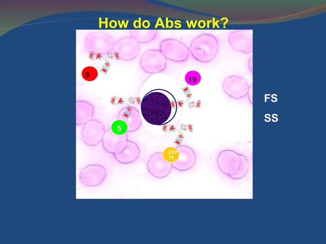 Lyme disease-antigen-test-flow-cytometry | PPT | Infectious Diseases ...