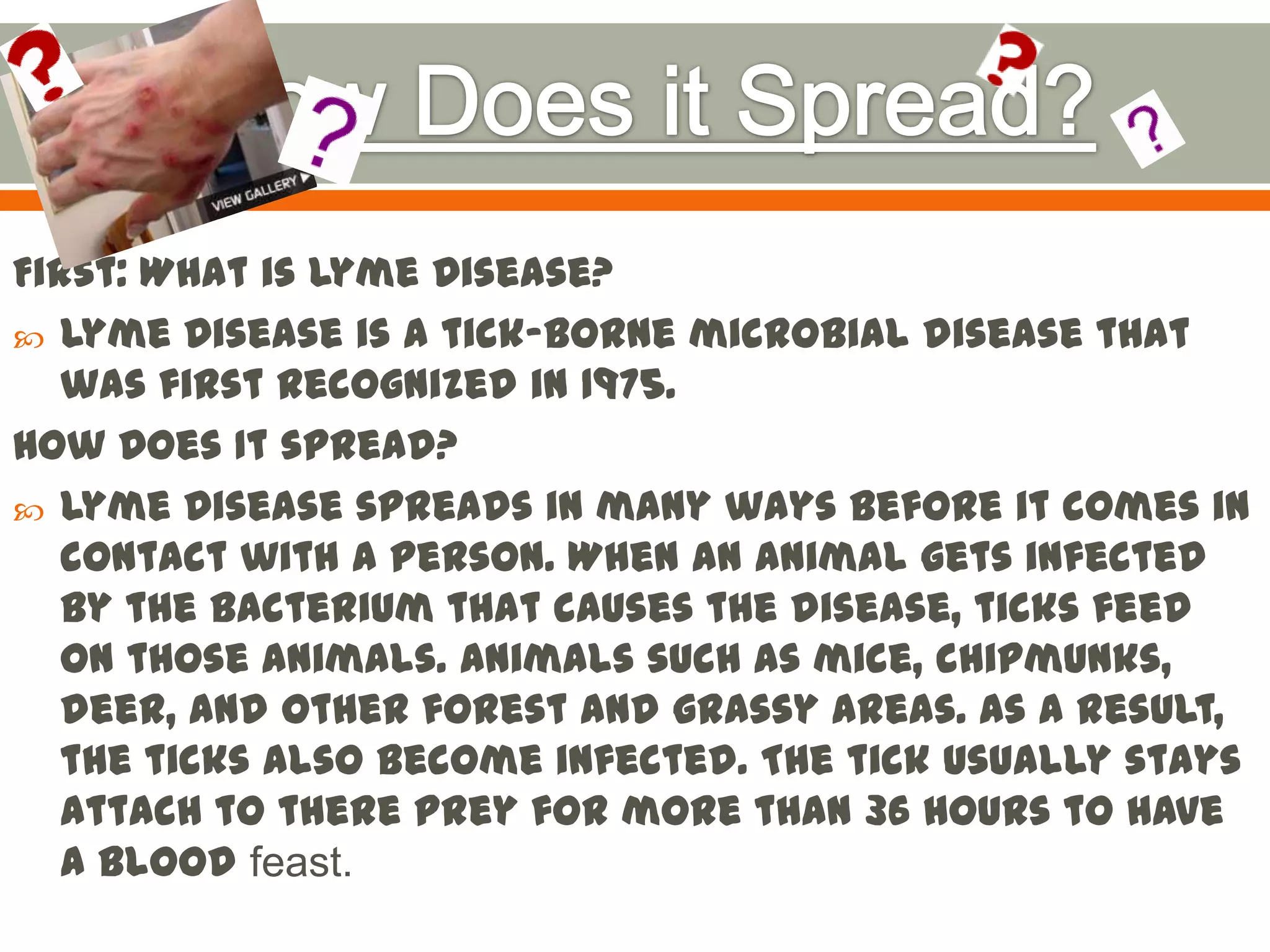Lyme disease | PPTX