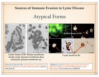 Lyme Disease Cell Structure