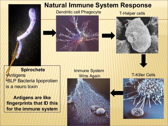 Lyme Disease