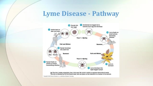Lyme disease