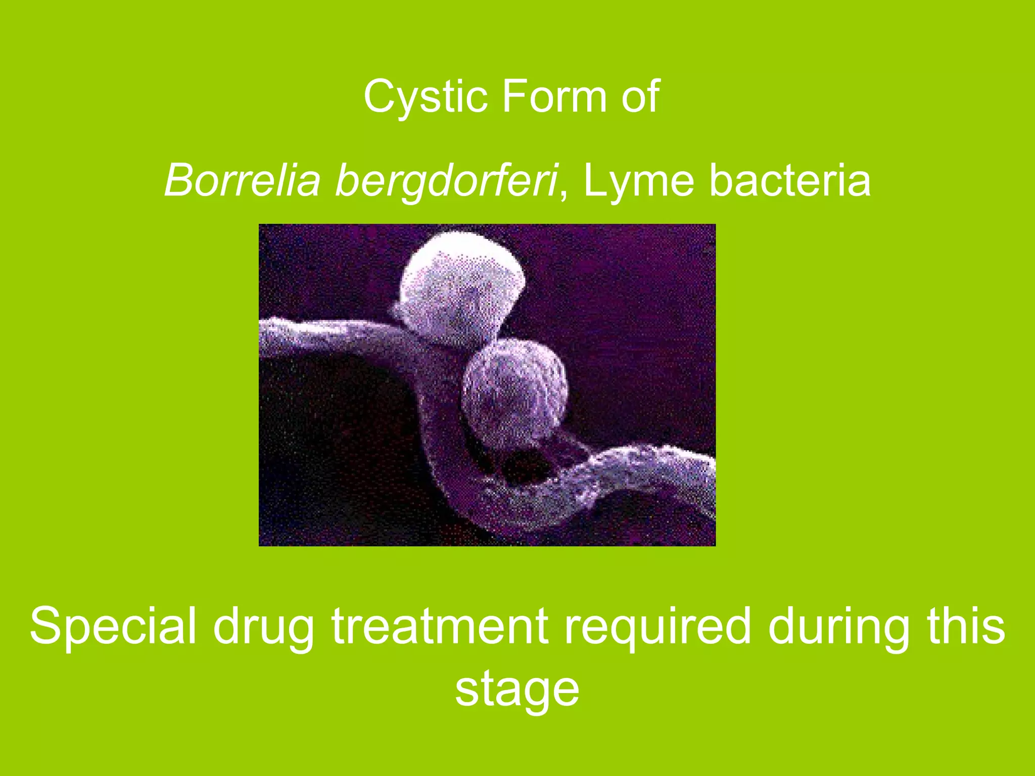 Lyme Disease | PPT