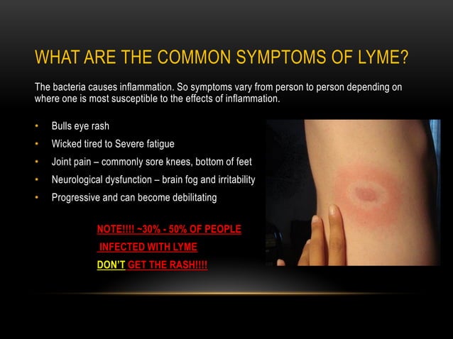 Lyme Disease is here NOW... and it is Nasty... Protect Yourself and Your Kids | PDF