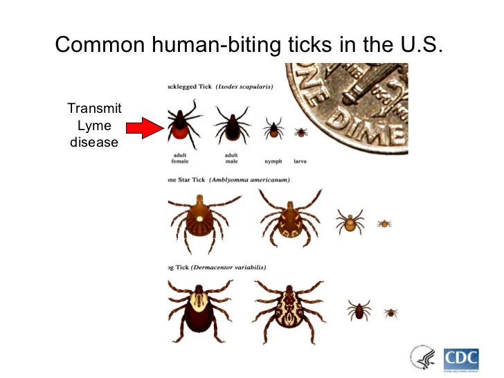 Normal Tick Bite Vs Lyme